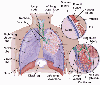 Understanding Your Lung Pathology Report | American Cancer Society