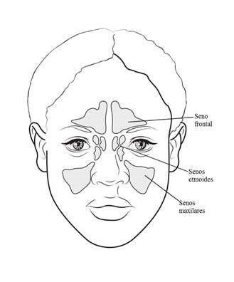 ¿Qué es el cáncer de cavidad nasal (nariz)? | ¿Qué es el cáncer de ...