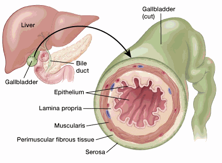 Gallbladder Cancer Stages | Gallbladder Cancer Staging | American Cancer Society