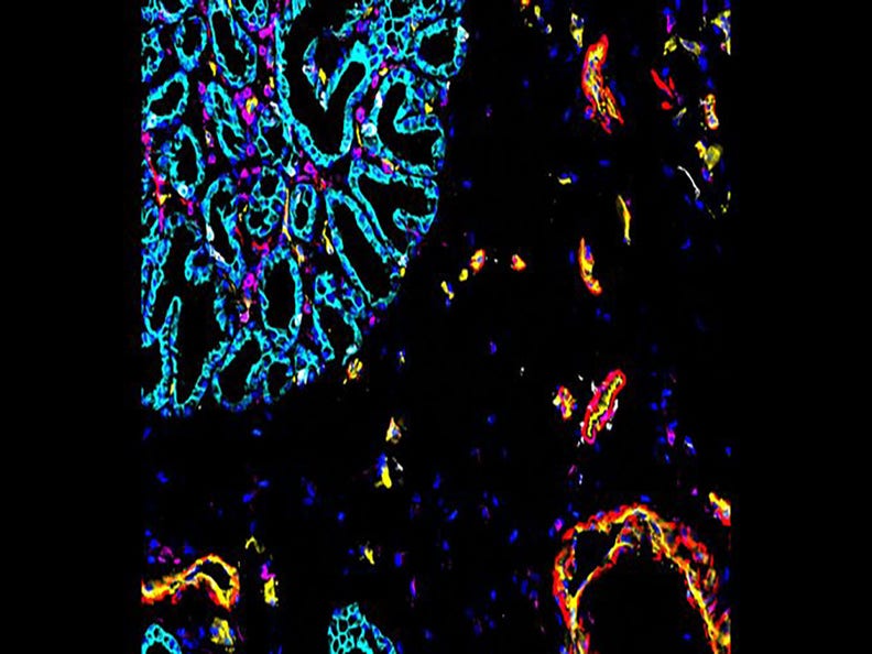 New Spatial Maps of the Intestine Show Cell-Level Details | American ...