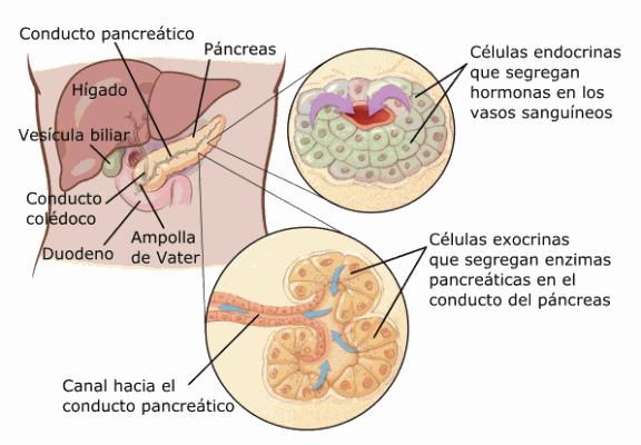 Qué Es El Cáncer De Páncreas Tipos De Cáncer De Páncreas American